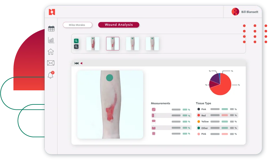 Wound Care Solutions | Wound EHR and Analytics