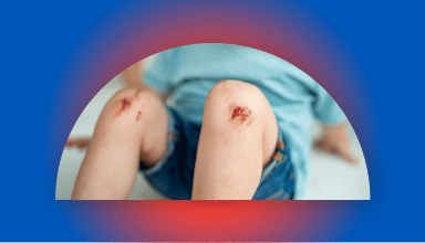 Scratch That: Superficial Wounds Explained - Net Health