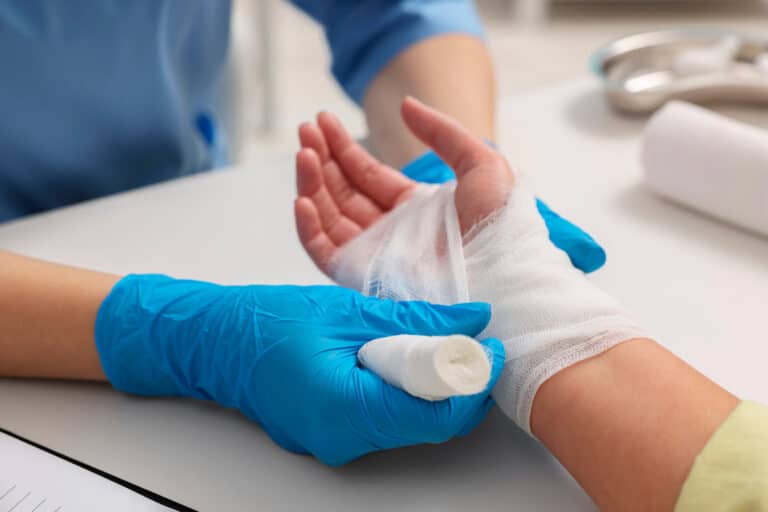 3rd Degree Burn Healing Stages: When to Stop Feeling the Burn - Net Health